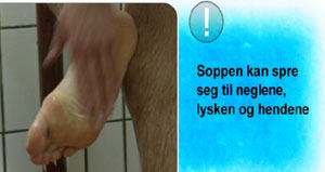 Fotsopp for en av ti – NRK Nyttig – Tips, råd og innsikt